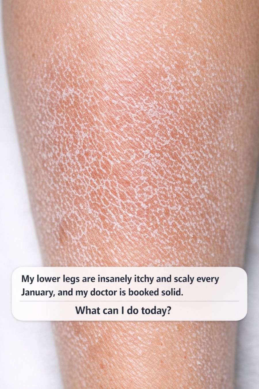 My lower legs are insanely itchy and scaly every January, and my doctor ...