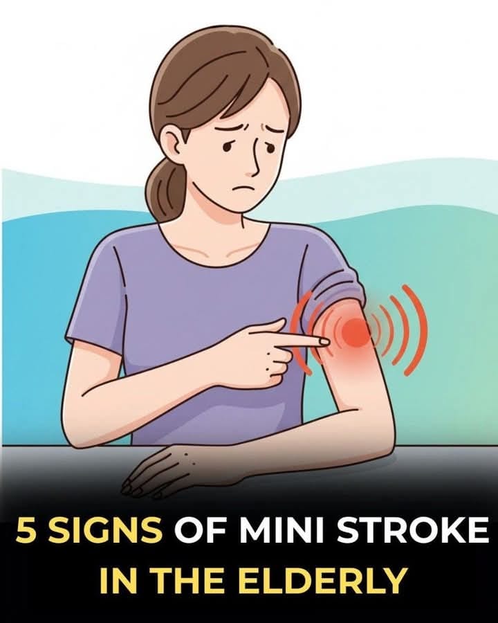 5 Signs of a Mini Stroke in the Elderly - Diy Home Garden