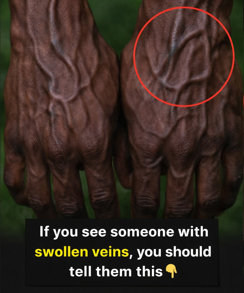 What the Veins on Your Hands Might Reveal About Your Heart Health - Diy ...